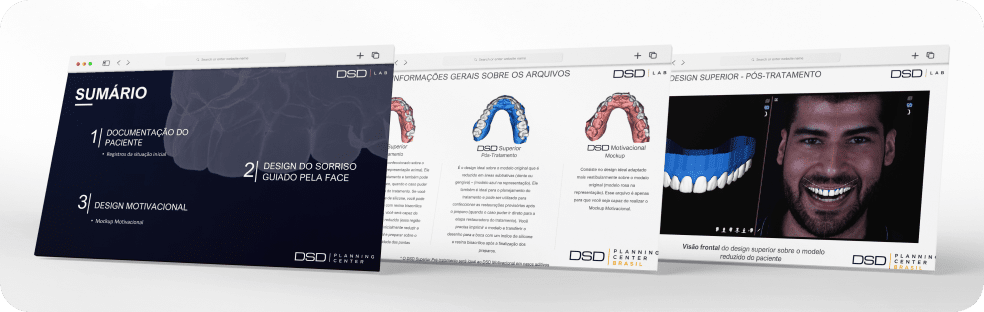 Digital Smile Design