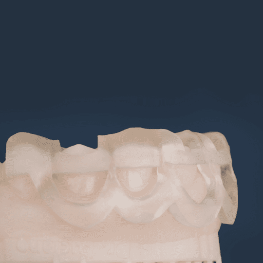 Digital Smile Design